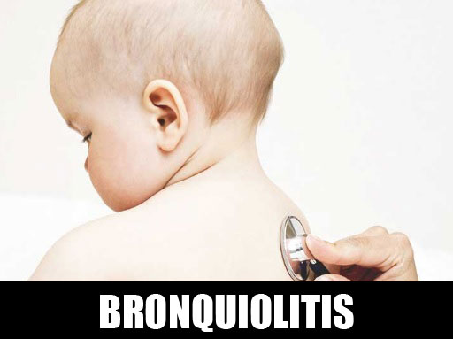 Bronquiolitis: qué es, síntomas tratamientos y más